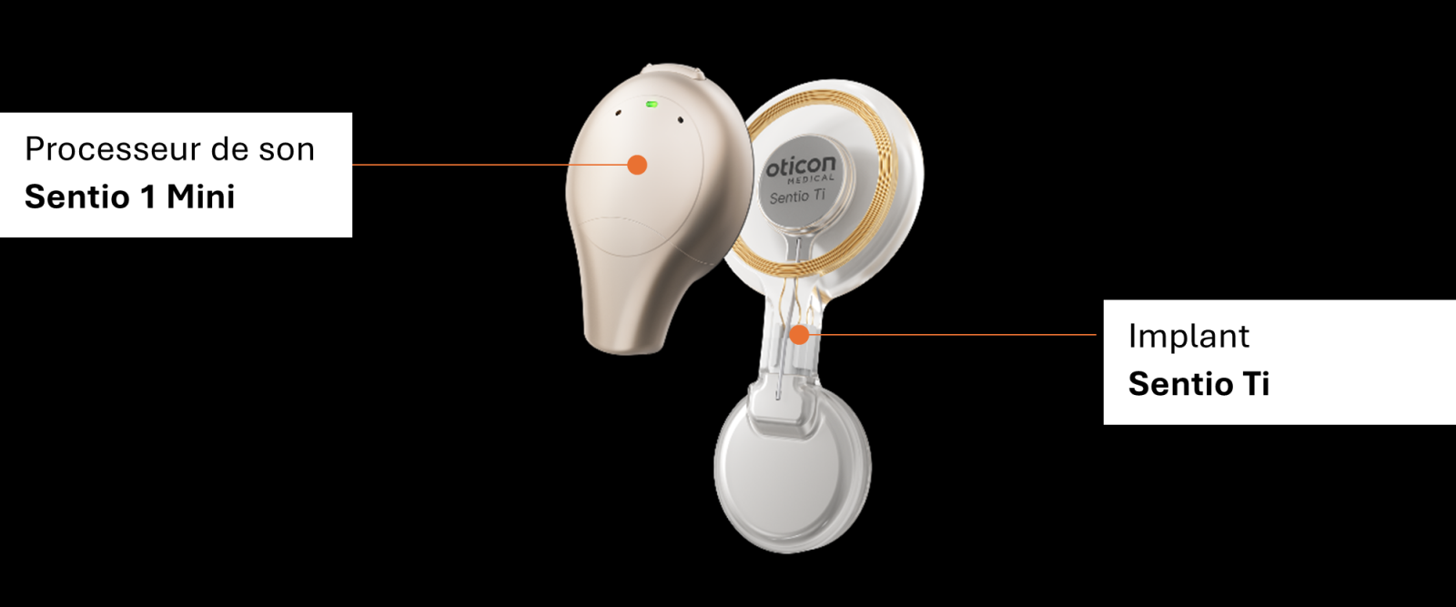 Oticon Medical – Le système Sentio™ obtient le marquage CE | Annuaire ...
